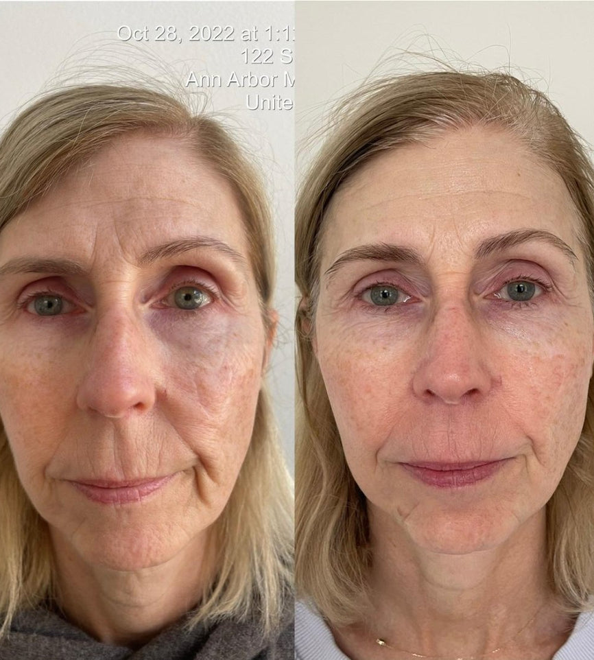 Advanced Korean Skincare Treatments for Estheticians | Kin – by Kin ...