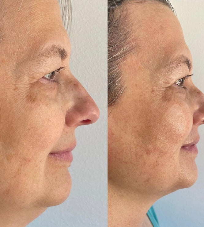 Advanced Korean Skincare Treatments for Estheticians | Kin – by Kin ...